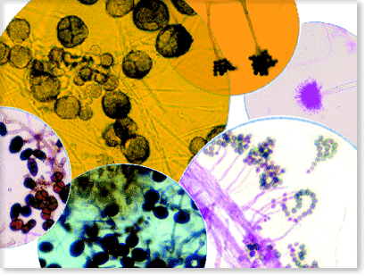 Mold Information and Resources